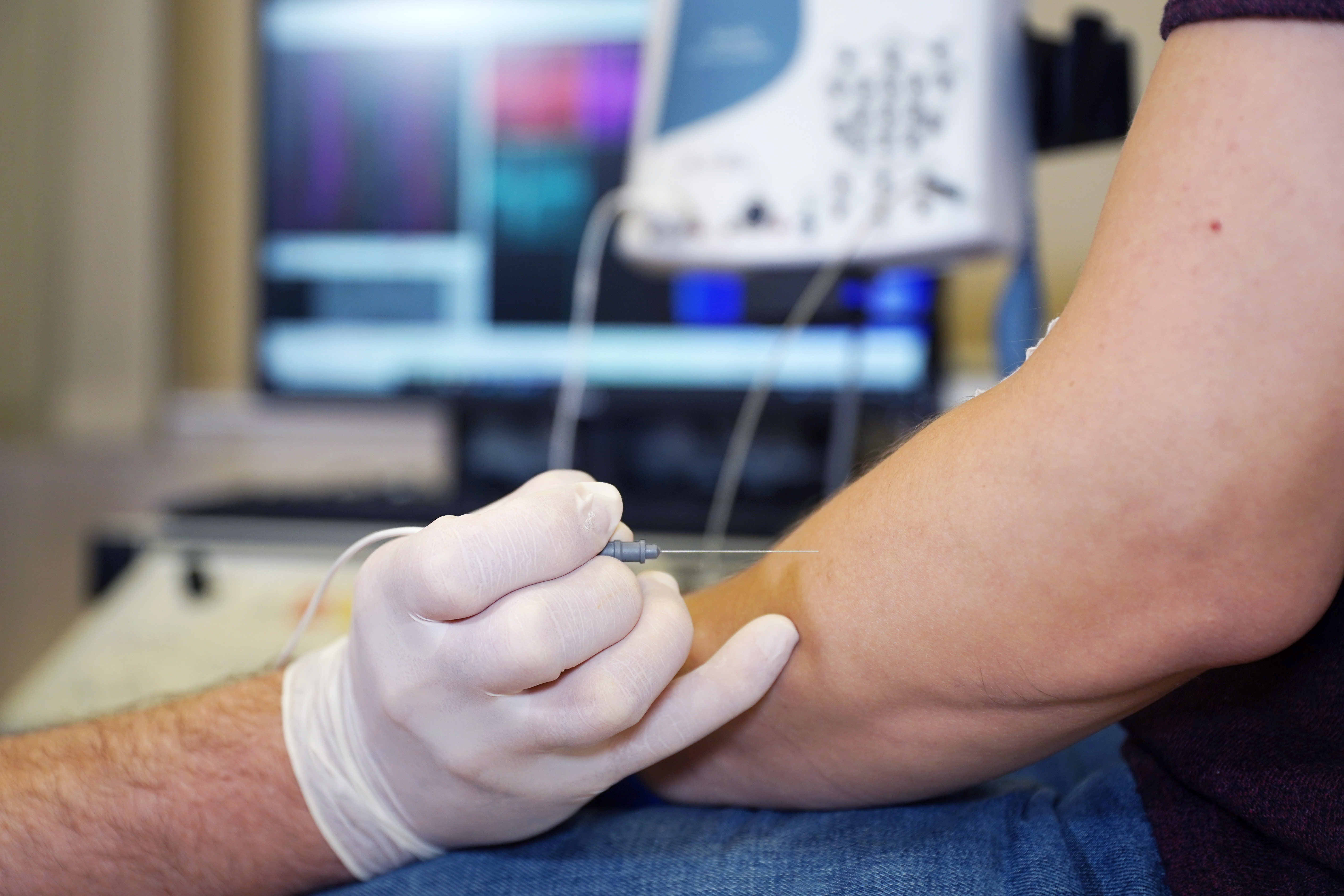 Elektromiográfia (EMG)